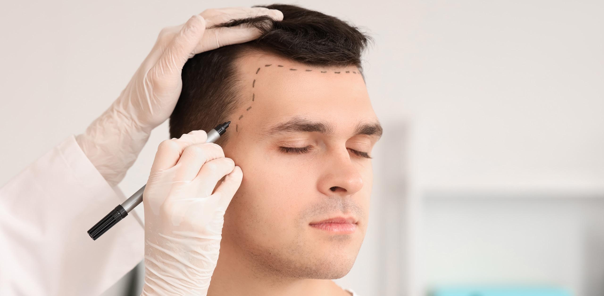 HAIR LOSS No More! | Expat Living Singapore - lifestyle - Read this ...