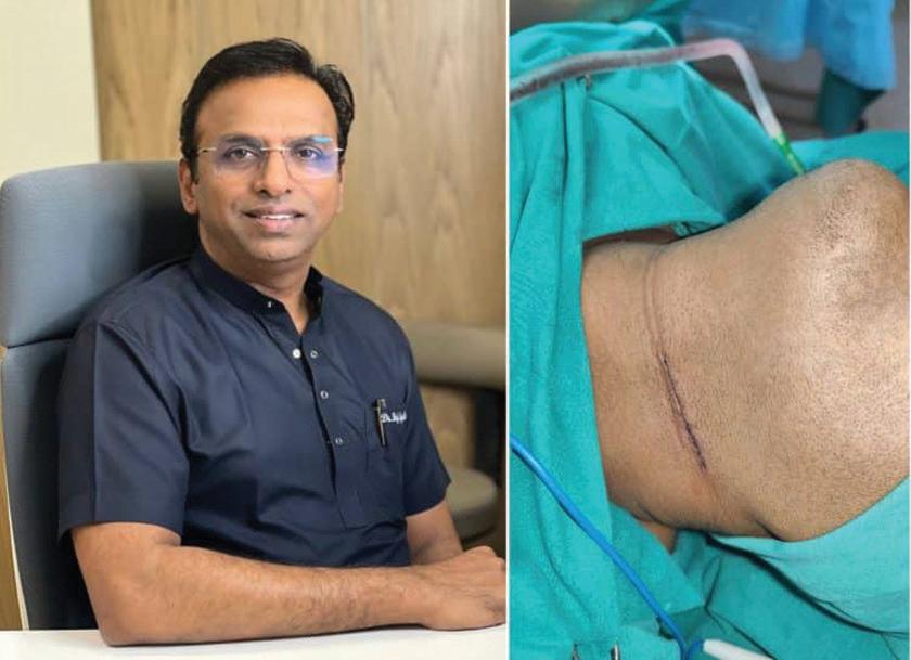 HCG TREATS 33-YR-OLD PATIENT WITH SCARLESS CANCER SURGERY | Healthcare ...