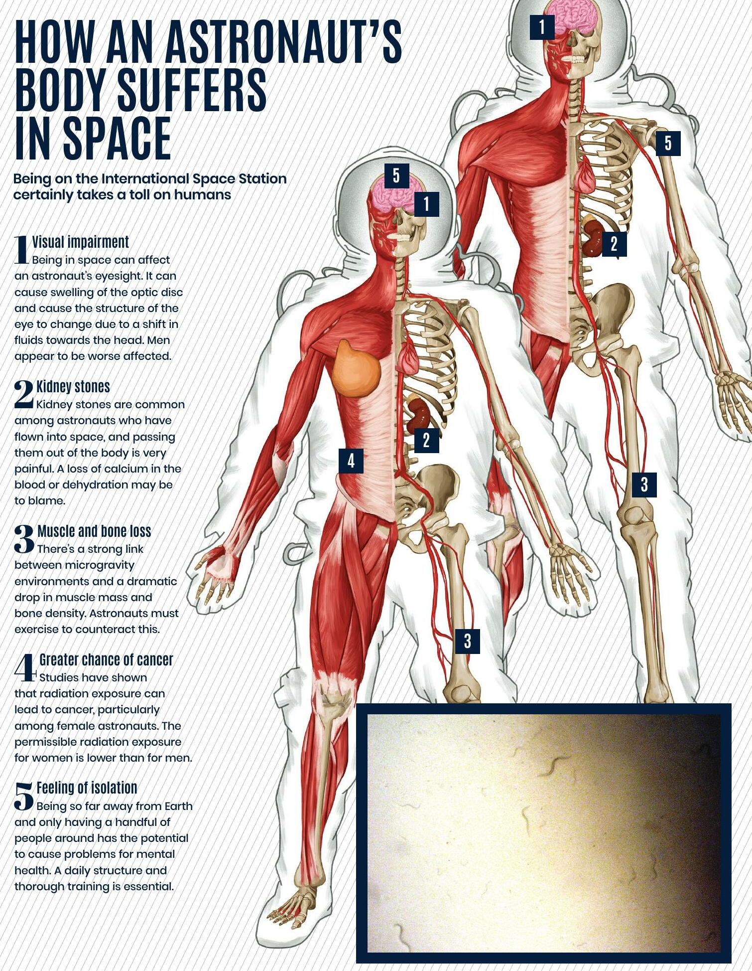Muscle Astronaut Atrophy