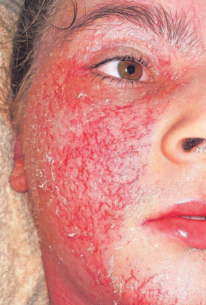 Woman's battle with medics over agonising skin condition | Birmingham ...