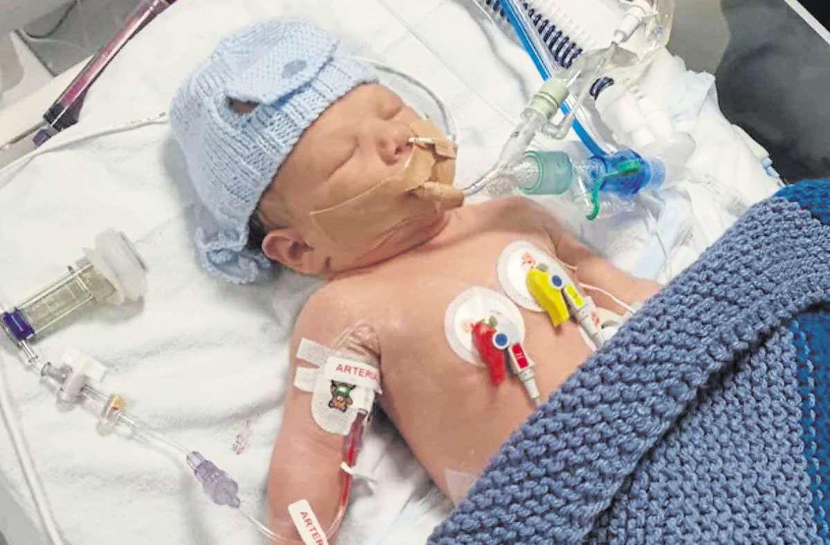 Family call for help after baby born with rare congenital heart ...