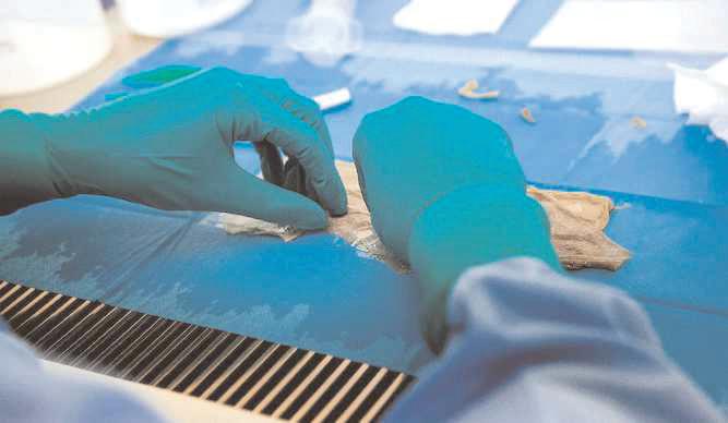 Indian Army launches skin bank for burn victims: All you need to know ...